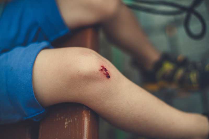 Is It Safe To Be Shot With An Airsoft Gun AirSoftLounge